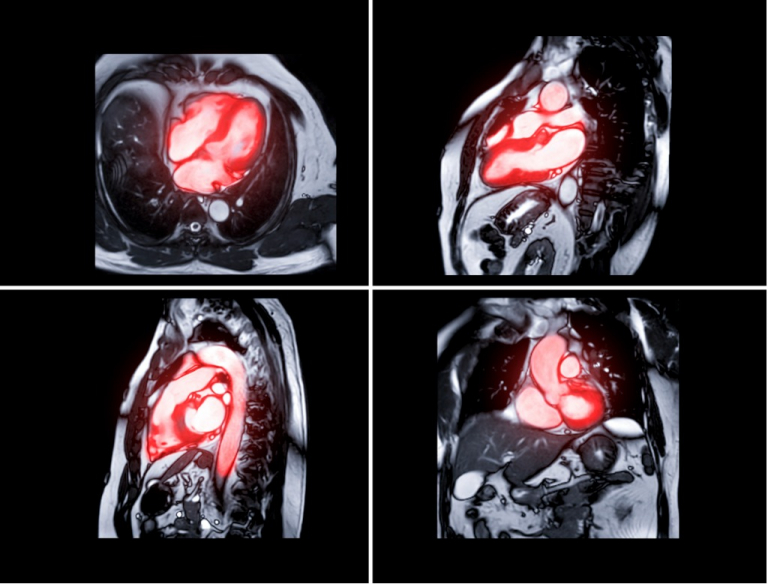 Cardiac Imaging Reads And Interpretations $14 Per Study
