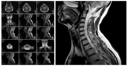 MRI Scan Reads And Interpretations From $48 Per Study