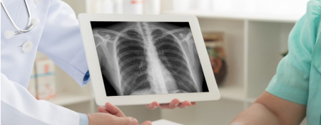 X-Ray Reads And Interpretations From $12 Per Study